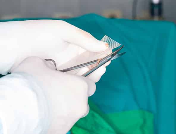 Defective Surgical Implants Can Be Serious and Even Deadly