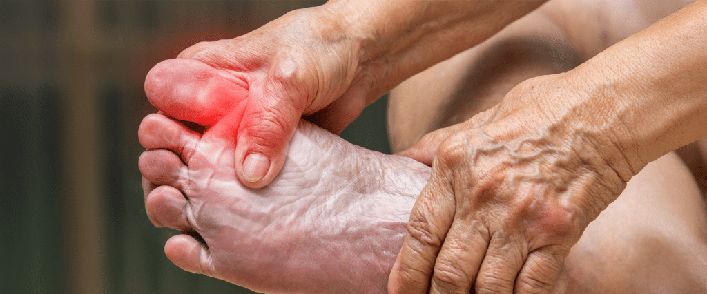 Cartiva Synthetic Cartilage Implant Lawsuits